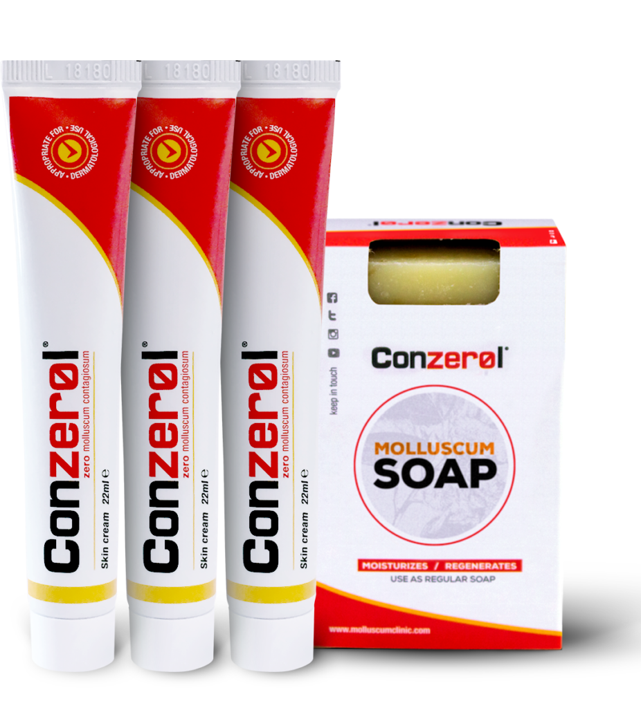 Kaufen Sie jetzt Conzerol zur Behandlung von Dellwarzen